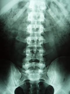 Radiologia: proyeccion de columna lumbosacra